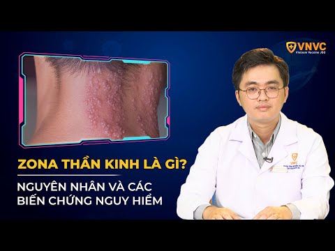 Bệnh Zona thần kinh là gì? Nguyên nhân và biến chứng nguy hiểm | BS. Bùi Thanh Phong | VNVC