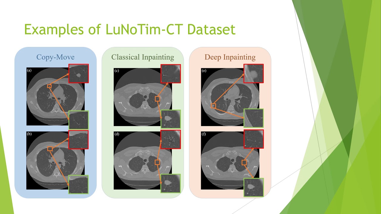 Medical Image Tampering Detection: a New Dataset and Baseline