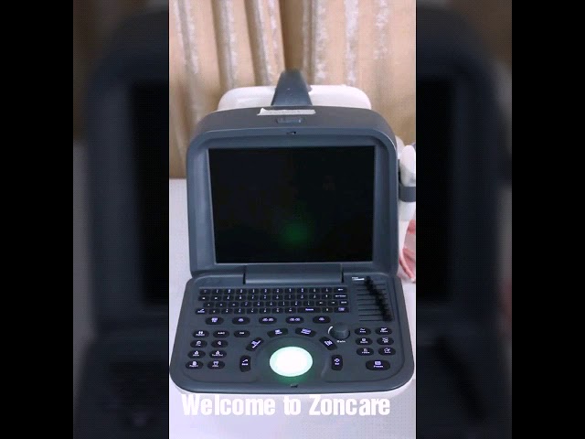 Ultrasound Machine - Zoncare i50 Ultrasound Machine Manufacturer from ...