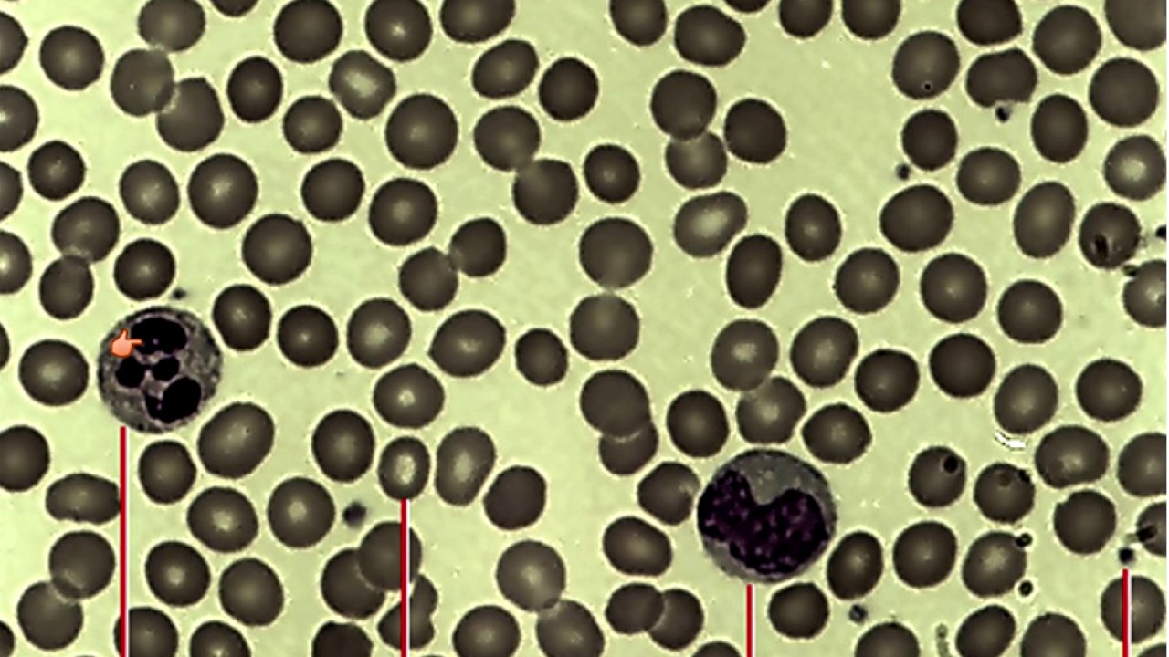 Hematology Virtual Lab