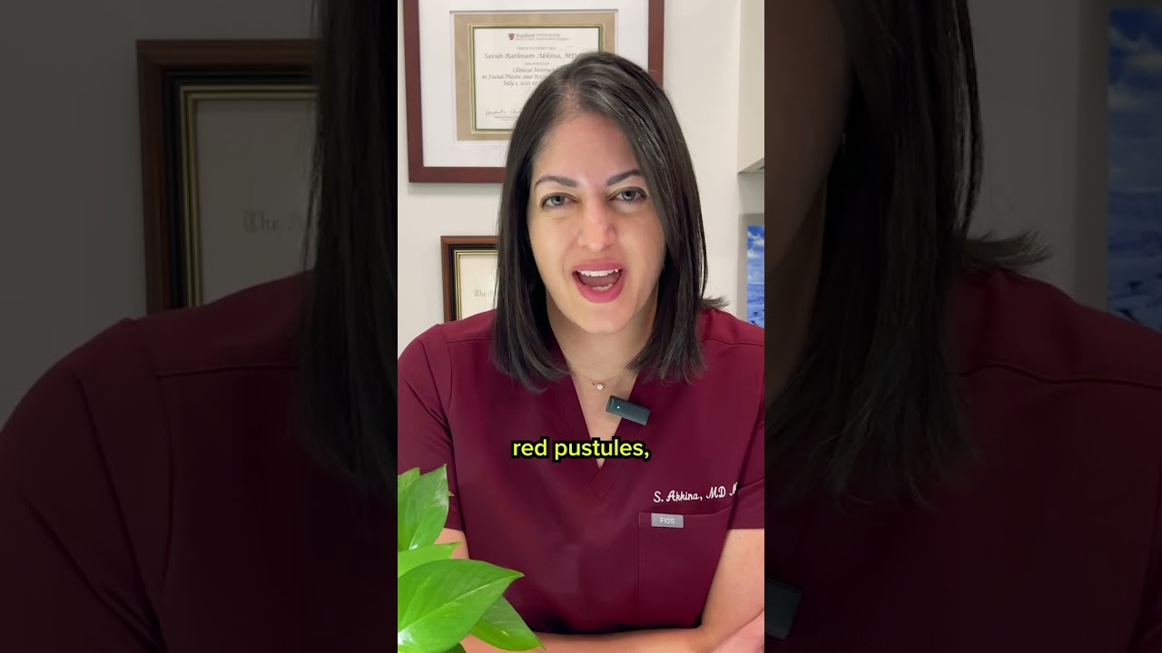 Facial Paralysis from a Childhood Virus?