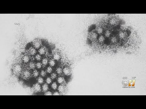 Norovirus, a stomach bug, is making its rounds