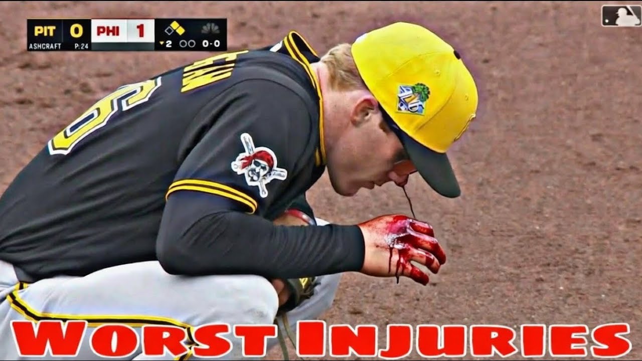 MLB | Worst Injuries 2026