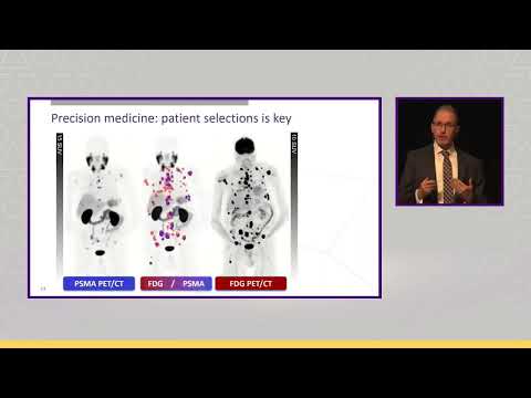 How I Select Patients for Lutetium-PSMA Radioligand Therapy