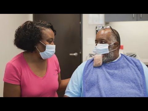 Some patients suffering from enlarged tongue
