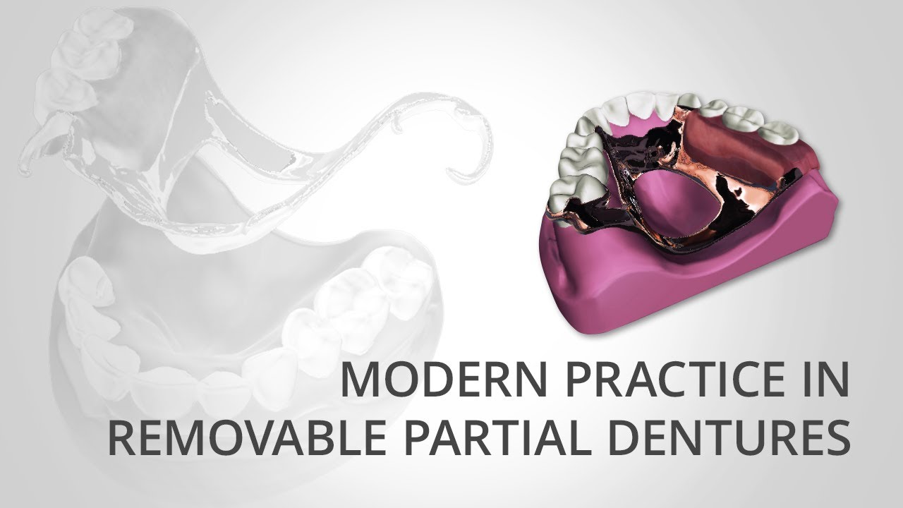 eHuman Removable Partial Dentures