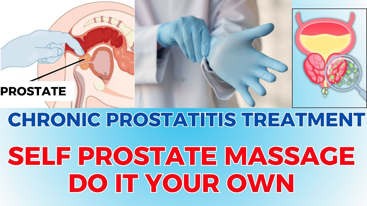 SELF PROSTATE MASSAGE: DO IT YOUR OWN... #prostatitis #prostatemassage