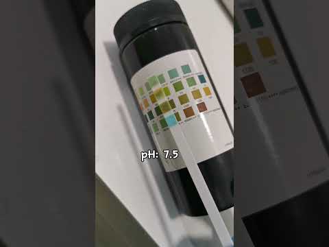 Urinalysis 2+ protein #laboratory #mls #microscope #urinesediment #cls #urinereagentstrips #urine