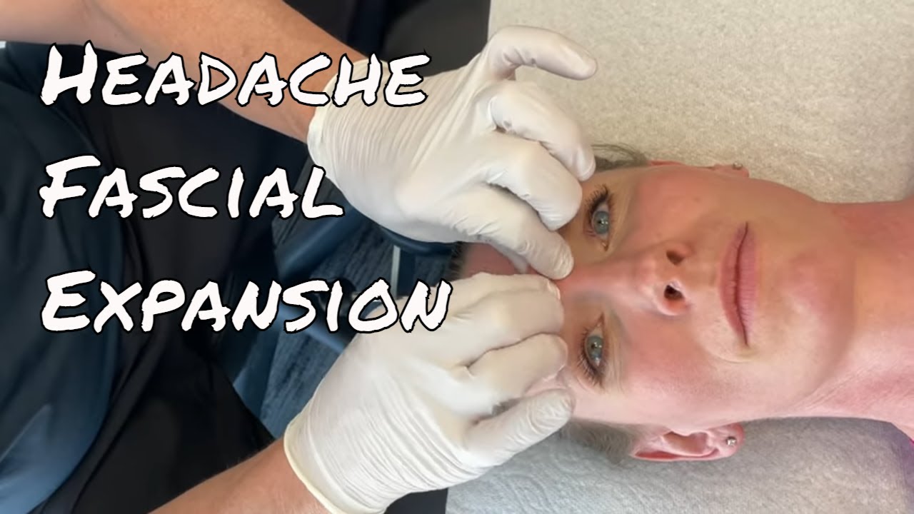 Fascial Expansion: MSR Headache Protocol