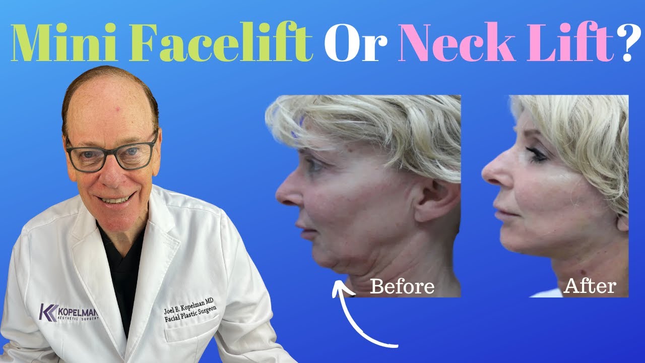 What Is A Mini Facelift More Ref