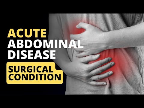 Understanding Acute Abdominal Disease #appendicitis #appendix #surgicalconditions #surgerysimplified