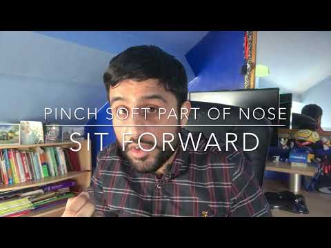 Acute Epistaxis (Nose Bleeds): Management: OWIN2K (Only what i need to know)
