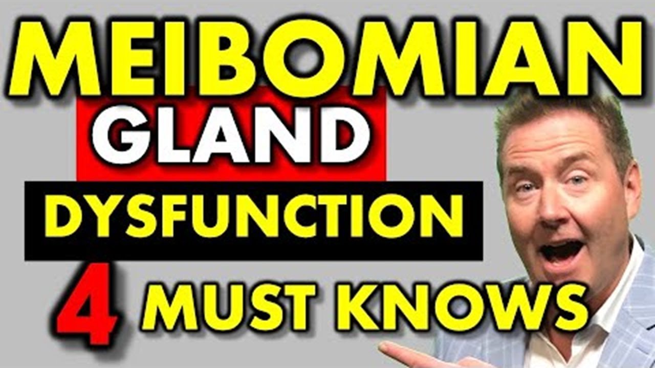 What is MEIBOMIAN GLAND DYSFUNCTION:  4 CAUSES of DRY EYE by youtube eye doctor