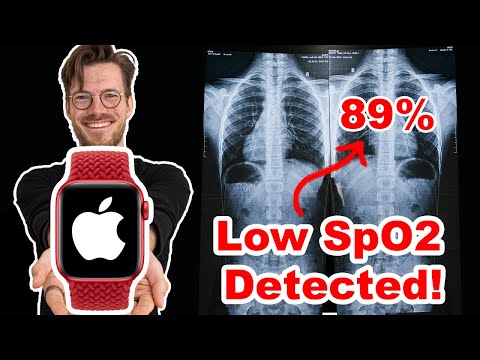 Apple Watch Scientific SpO2 Test (Oxygen Saturation Review)