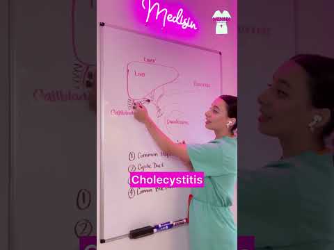 The Biliary System - Cholelithiasis, Choledocolithiasis, Cholecystitis, Cholangitis, and More!