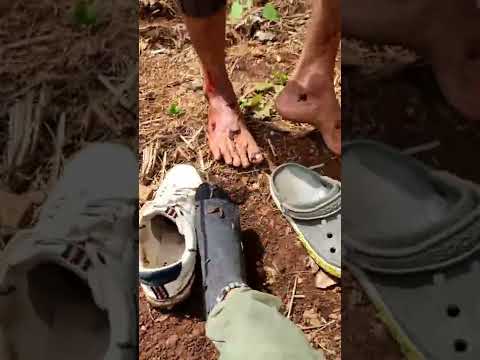 how to get rid of these!🥺🐛 #forefin #forest #leech #friends #shorts #like #unplanned #2022 #trekking