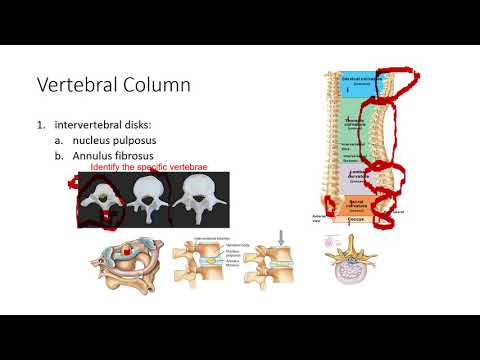 Skeletal System PPT - slide 9a