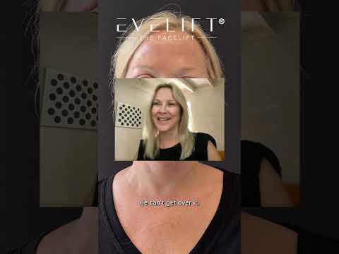 Check-In With EVE Lift™ Patient Sara | Eden Plastic Surgery: Dr. Ali Charafeddine, MD