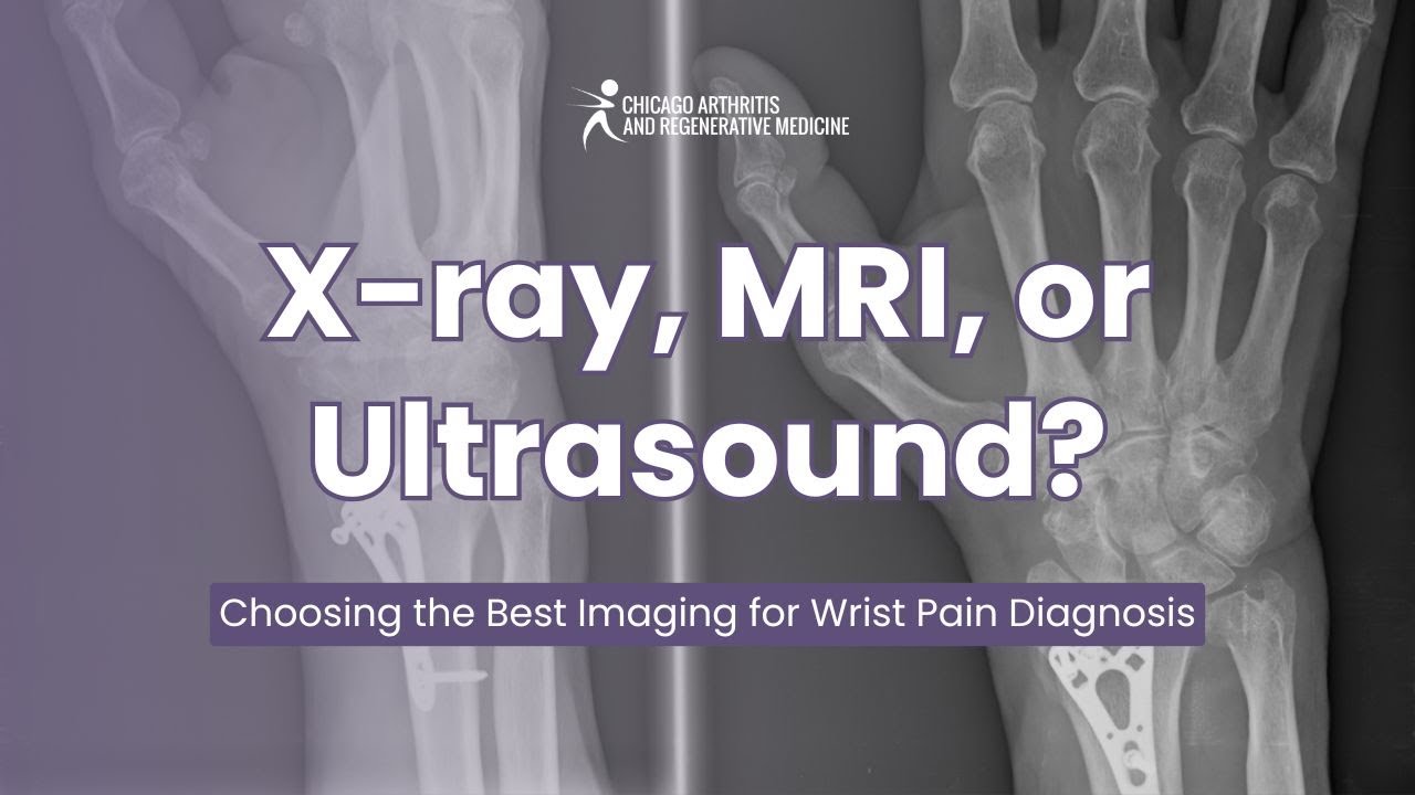 X-ray, MRI, or Ultrasound: Choosing the Best Imaging for Wrist Pain ...