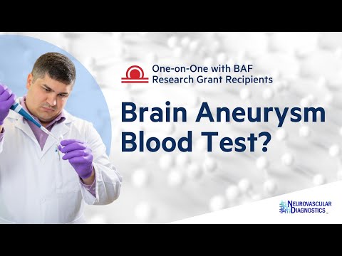 Diagnosing unruptured brain aneurysms with a blood test - Vincent Tutino explains | BAF