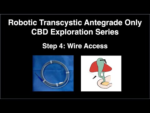 Step 4: Wire Access - Robotic CBD Exploration Series