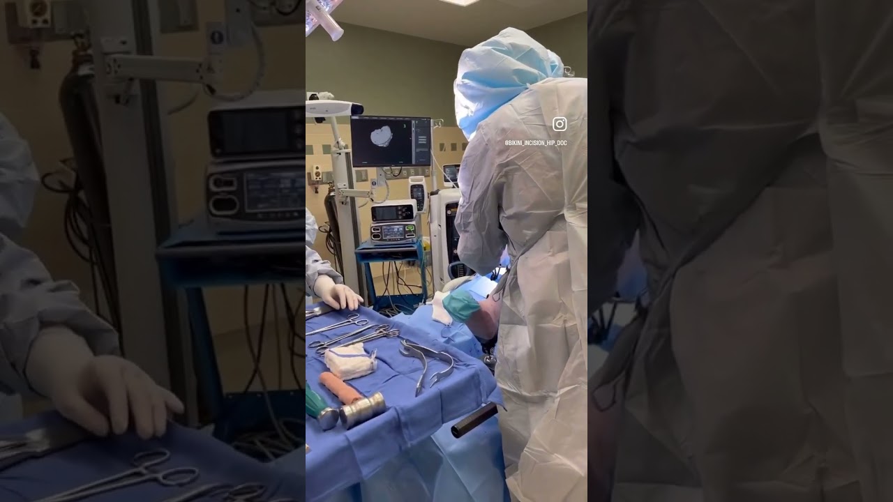 MAKO Revision Total Knee Replacement Dr. Robert Cagle