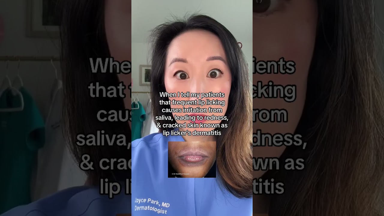 How to Heal Lip Licker’s Dermatitis