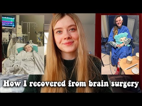 2 weeks after my brain surgery | recovery story, what to expect after craniotomy.