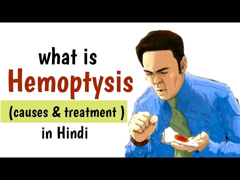 what is Hemoptysis? | causes, Diagnosis & Treatment in Hindi #hemoptysis