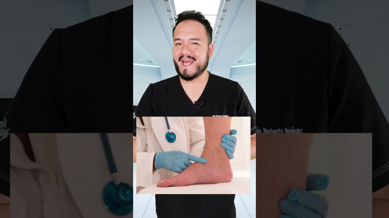 ¿Qué es la flebitis y cómo puedes reconocerla?