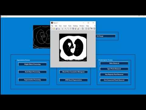 Fir Filter Matlab Projects