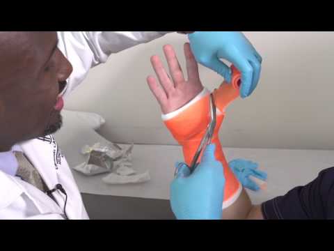 AOA - The Casting Process with Dr. Cameron Atkinson