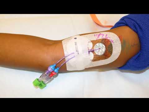 What is a peripherally inserted central catheter?