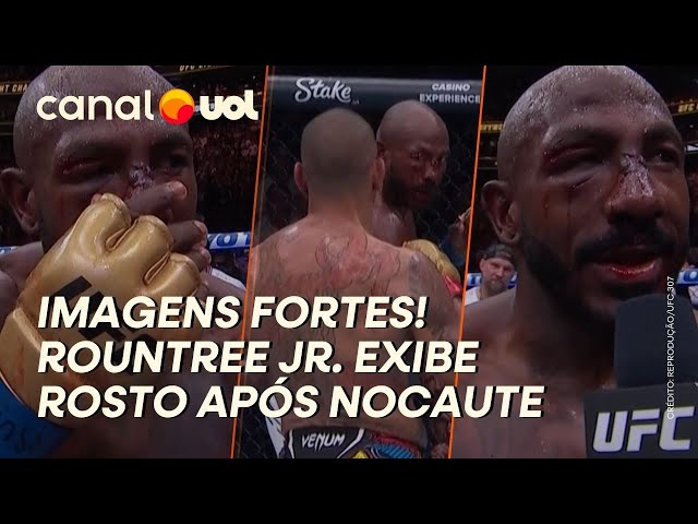 UFC: Rountree mostra rosto 'remendado' após luta contra Poatan