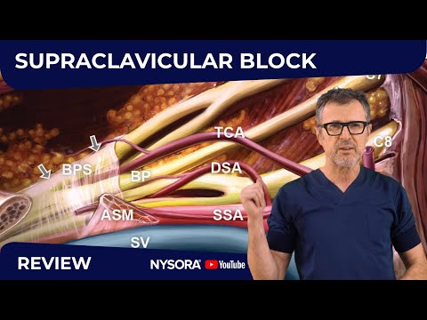 Supraclavicular Block: WHY, HOW, WHERE, AND WHAT’S NEW