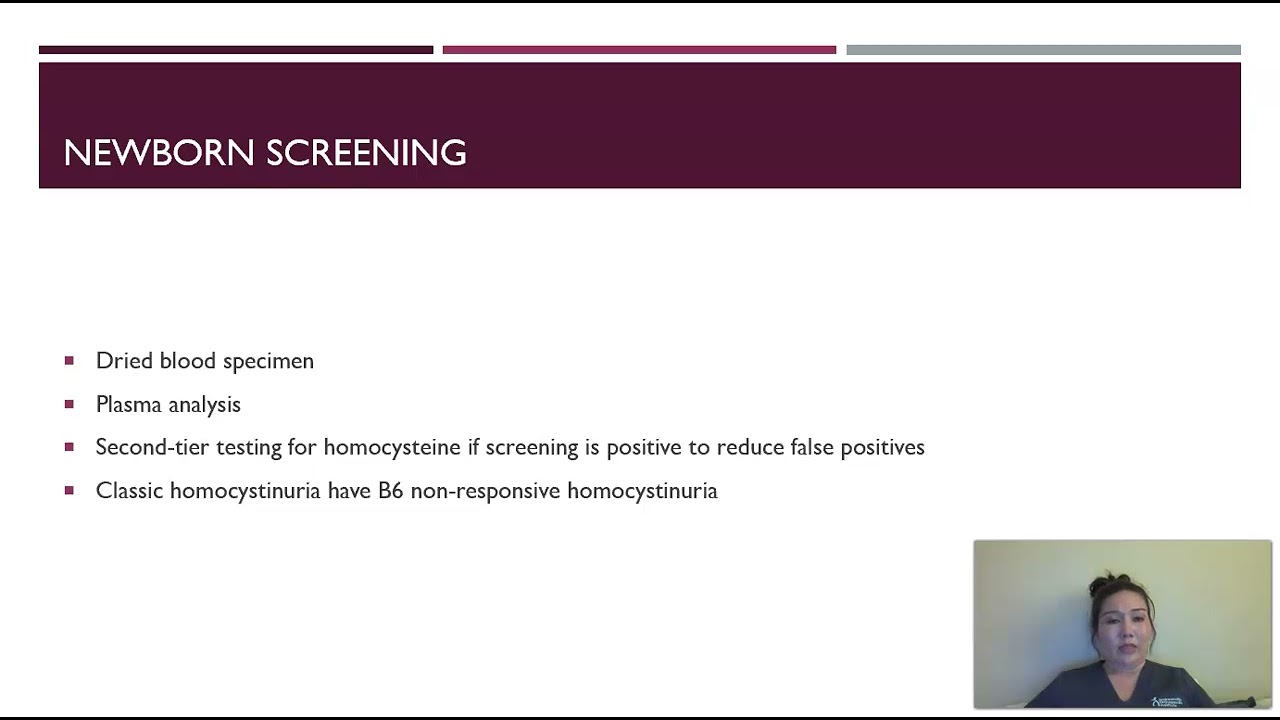 Homocystinuria Presentation