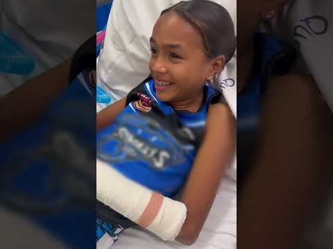 Broken arm #happygas