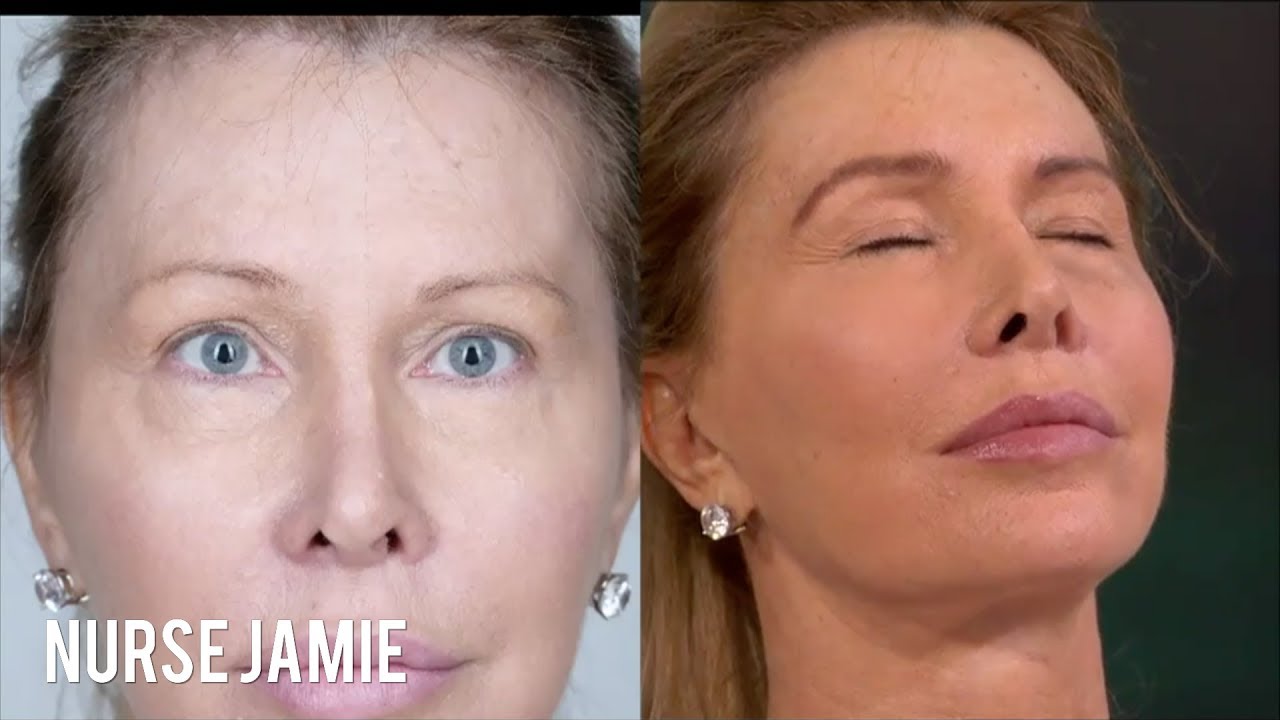 Before and After Eyebrow Threading | Nurse Jamie