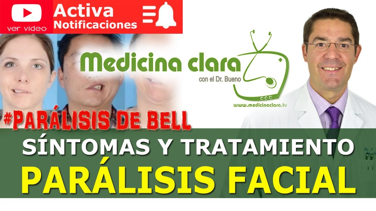 Parálisis facial periférica, Parálisis de Bell, Bell´s Palsy ¿Qué es exactamente? | Medicina Clara
