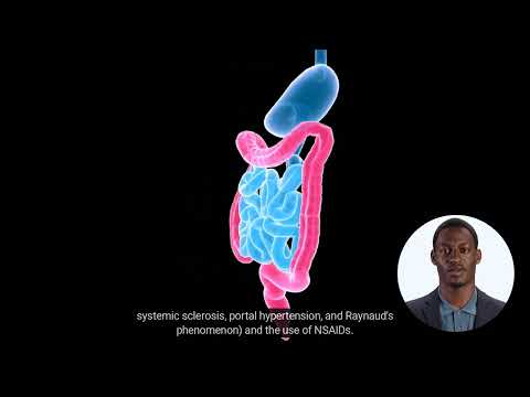 Watermelon Stomach Causes And Treatment