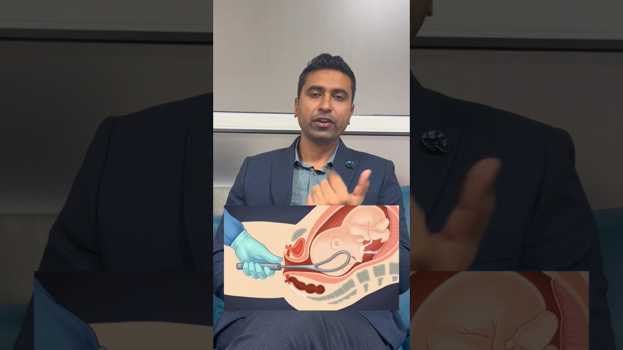 Vesicovaginal Fistula Causes by dr anil Kumar T