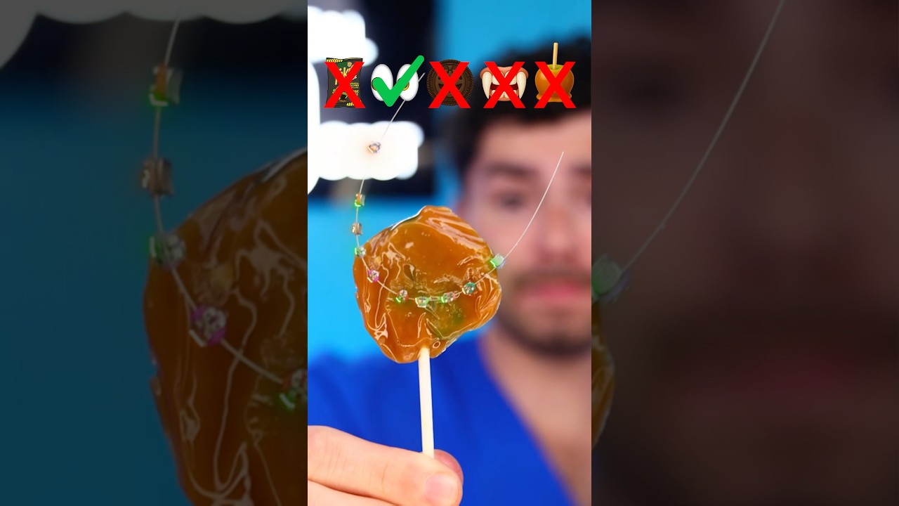 Braces Approved Halloween Snacks ✅