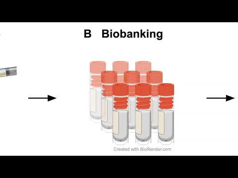 Biobanking of Human Aqueous and Vitreous Liquid Biopsies for Molecular Analyses | Protocol Preview
