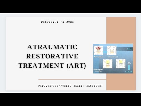 ART(ATRAUMATIC RESTORATIVE TREATMENT )