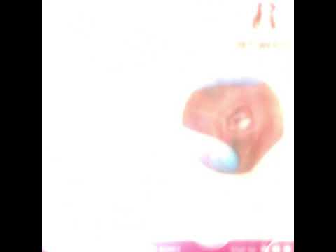 cherry eyes in pets