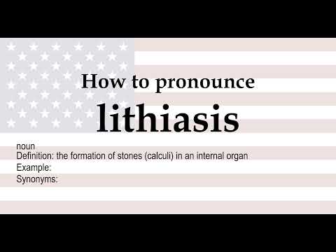 lithiasis