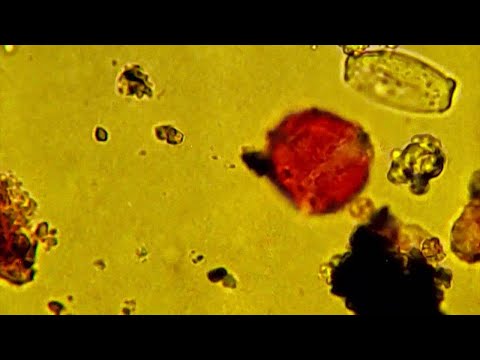 Bad allergies? Here's how Houston health officials track pollen and allergy issues in our community