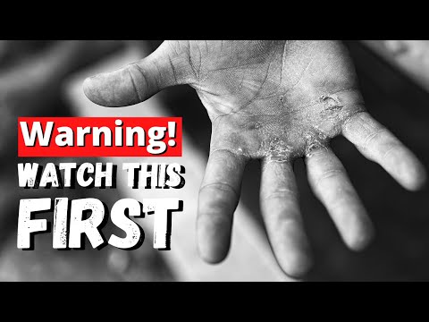 WATCH THIS Before Shaving Your Hand Calluses! | Callus Removal Tip!