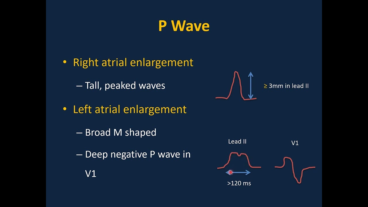 Pediatric ECG Interpretations