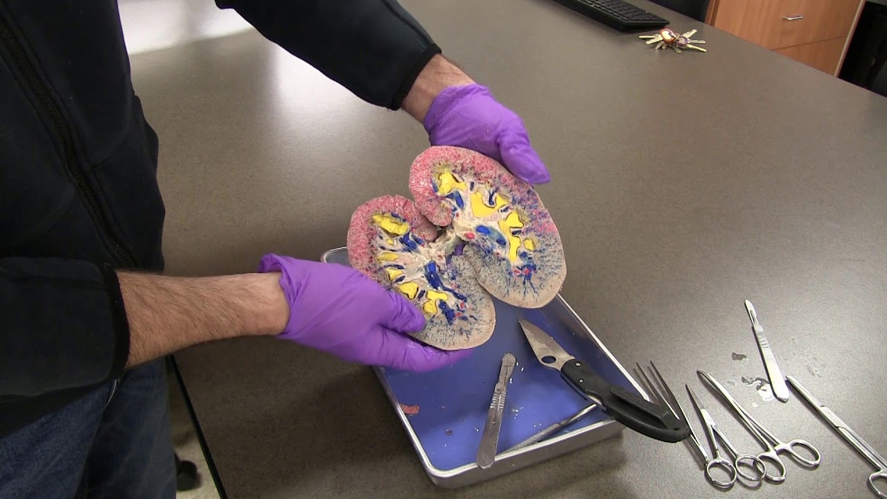 Triple Injected Kidney Dissection